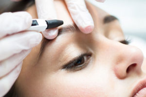 Advanced Electrolysis – ES Skin Clinic